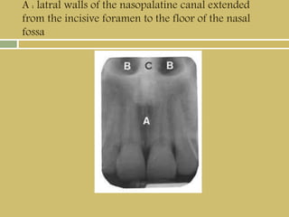 Normal oral radiographic anatomy | PPTX