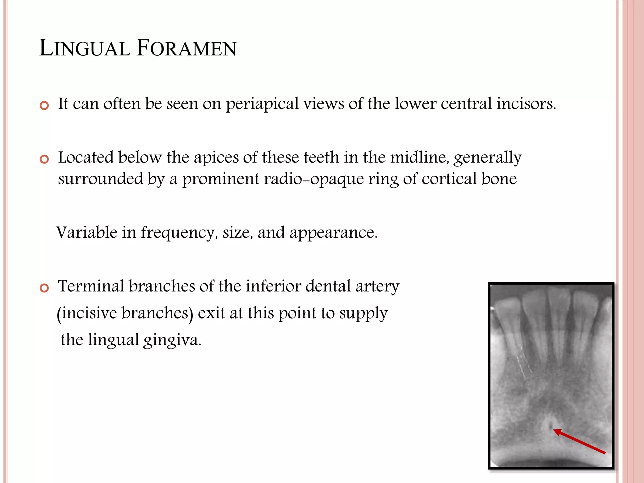 Normal radiographic anatomy | PPTX