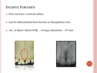 Normal radiographic anatomy | PPTX