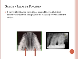 Normal radiographic anatomy | PPTX