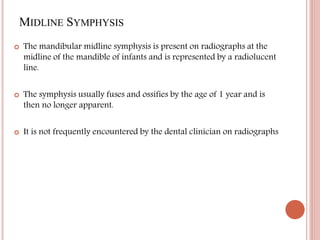 Normal radiographic anatomy | PPTX