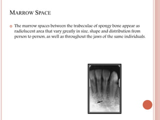 Normal radiographic anatomy | PPT