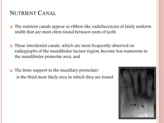 Normal radiographic anatomy | PPTX