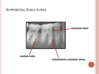 Normal radiographic anatomy | PPTX