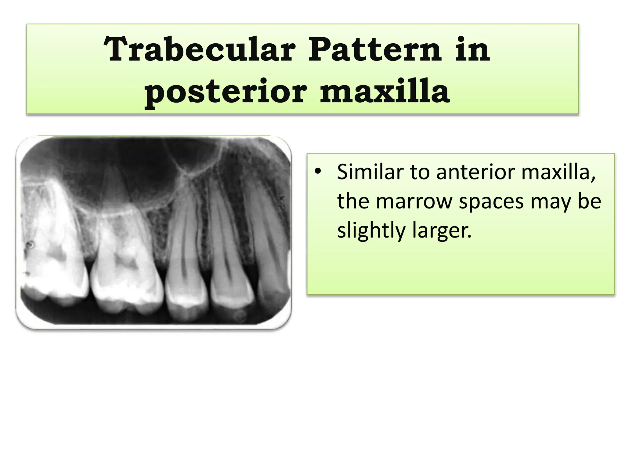 Normal radiographic anatomy .pptx