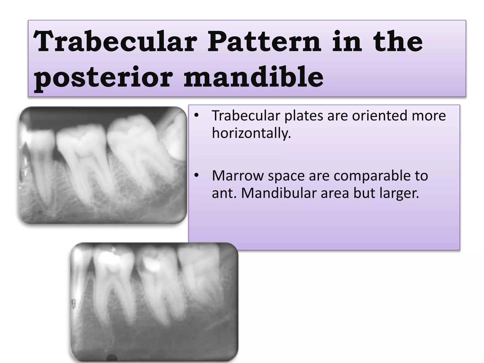 Normal radiographic anatomy .pptx