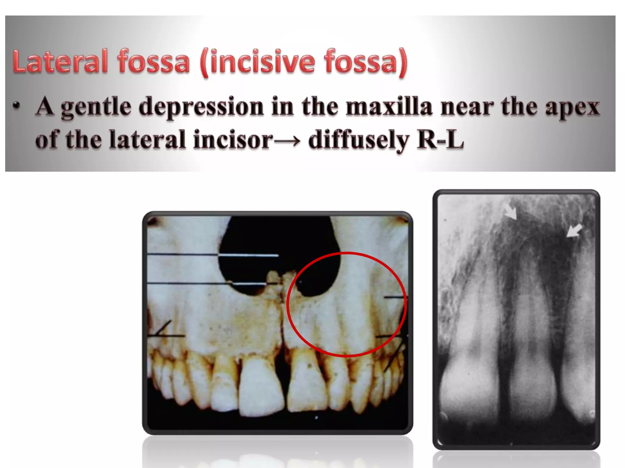 Normal radiographic anatomy .pptx