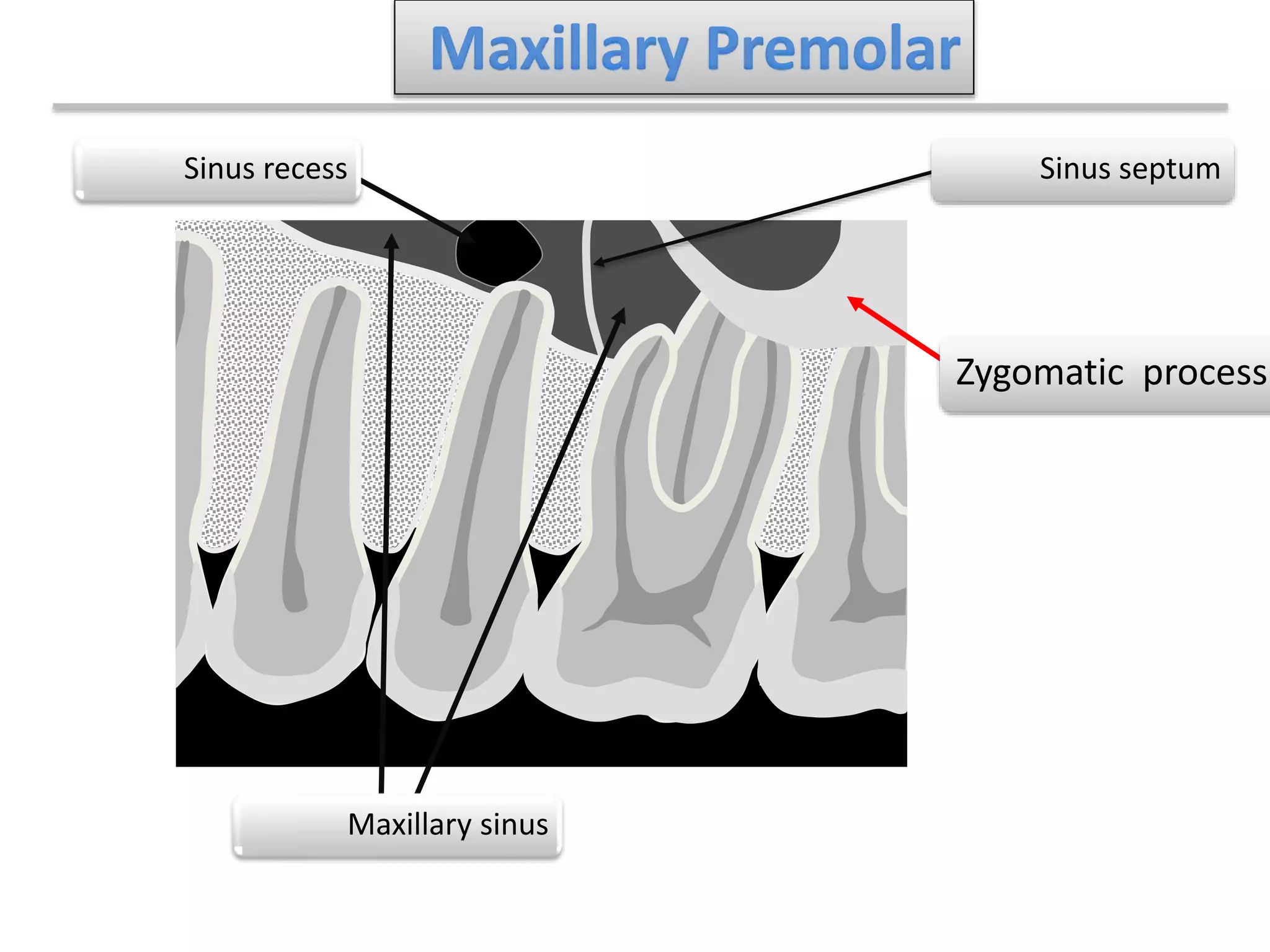 Normal radiographic anatomy .pptx