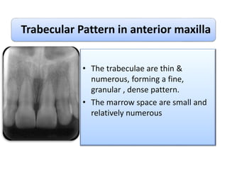 Normal radiographic anatomy .pptx
