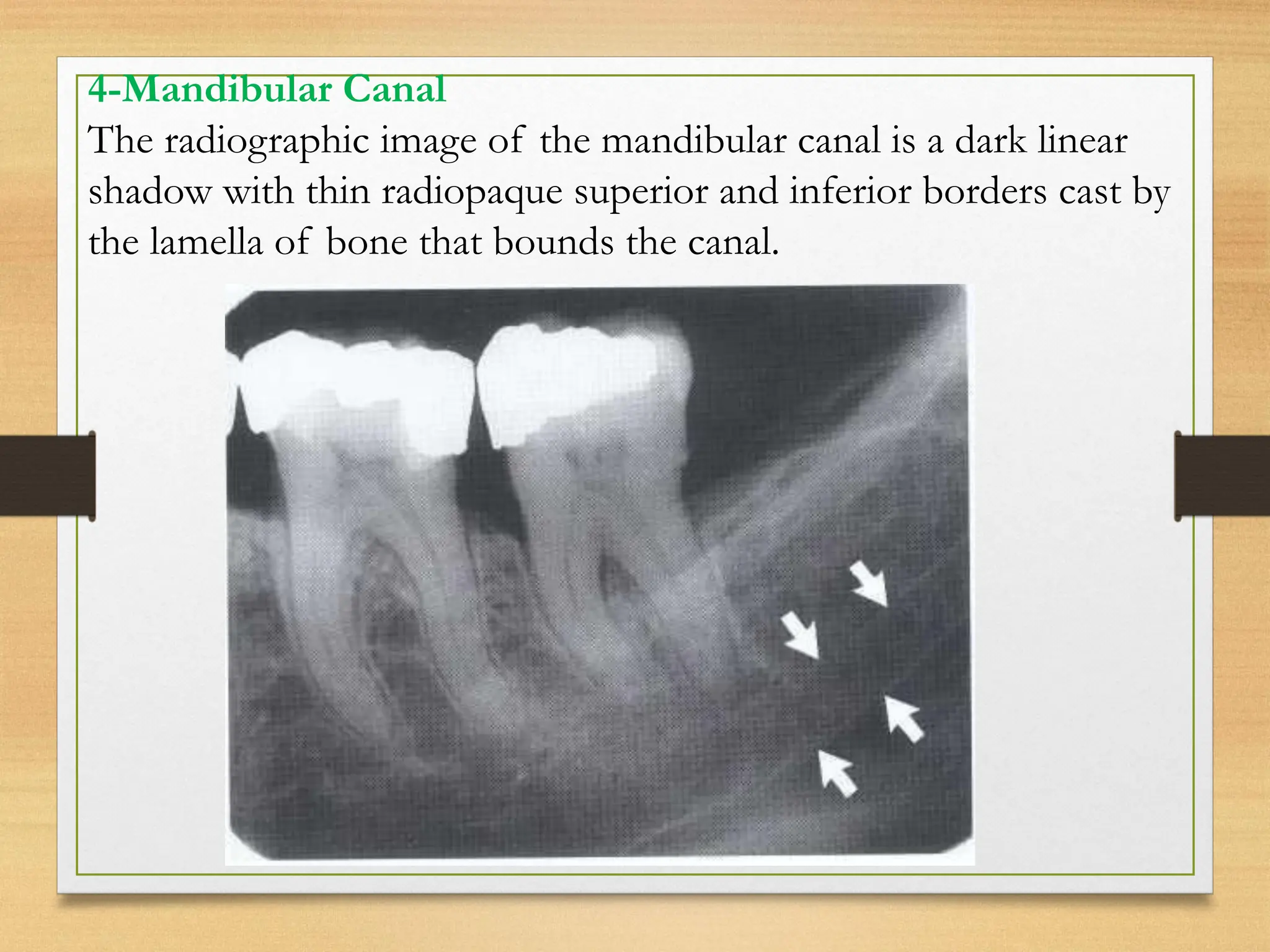 Normal radiographic anatomy in a human.pdf | Free Download