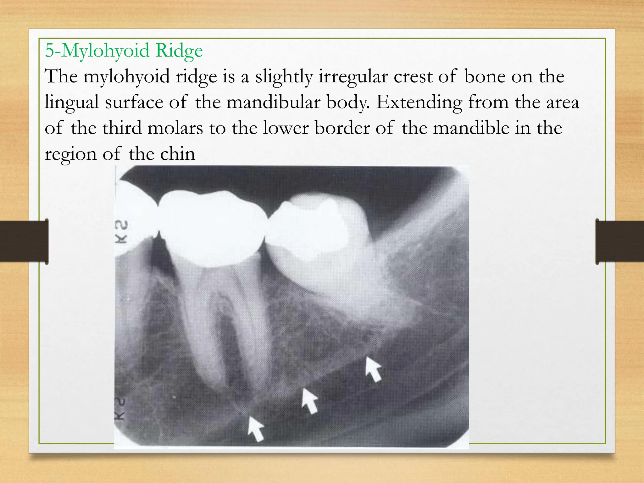 Normal radiographic anatomy in a human.pdf | Free Download