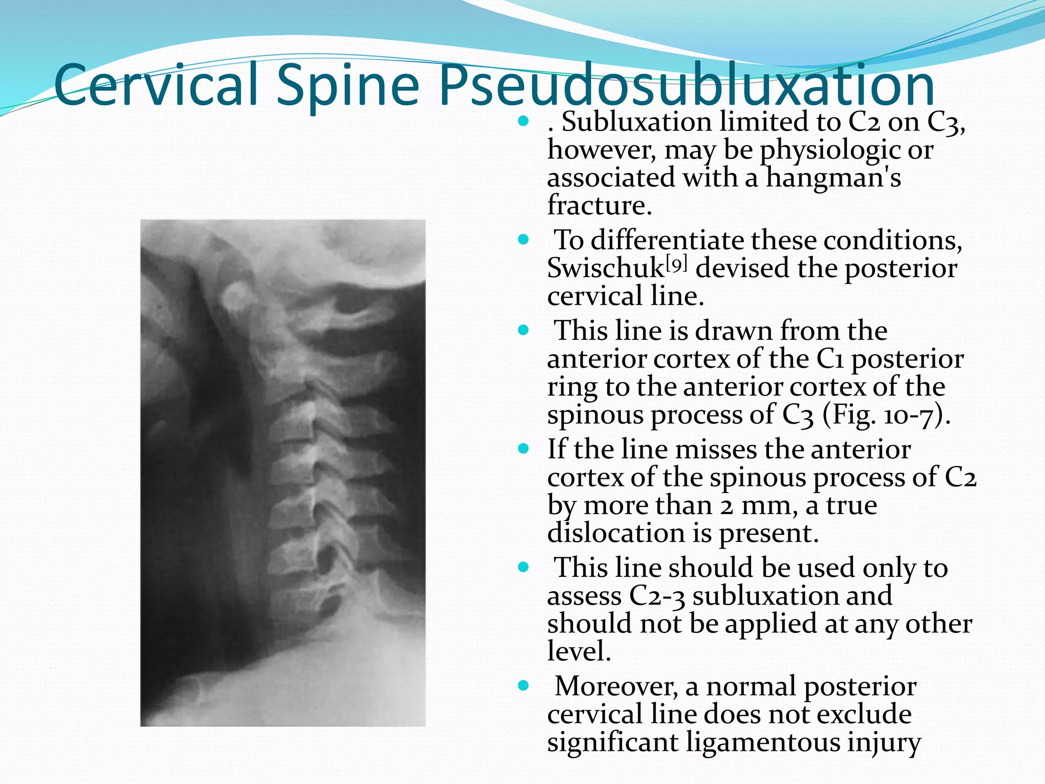 Normal radiographic variants of immature skeleton | PPTX