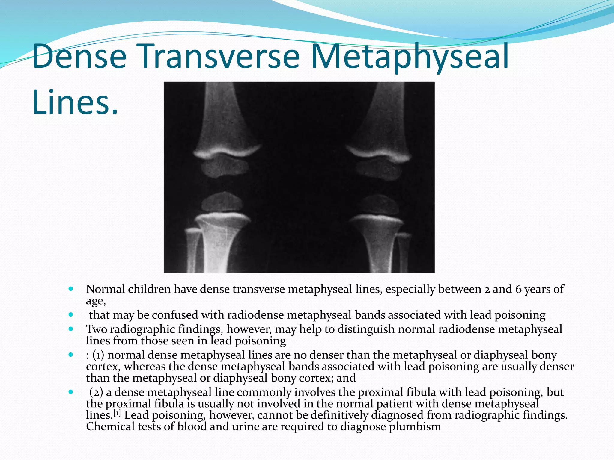 Normal radiographic variants of immature skeleton | PPTX
