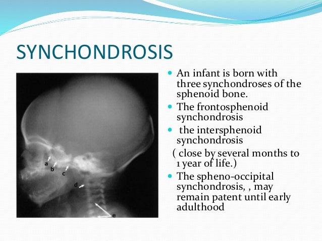 Normal radiographic variants of immature skeleton