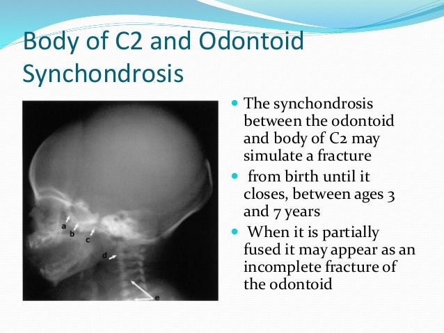 Normal radiographic variants of immature skeleton