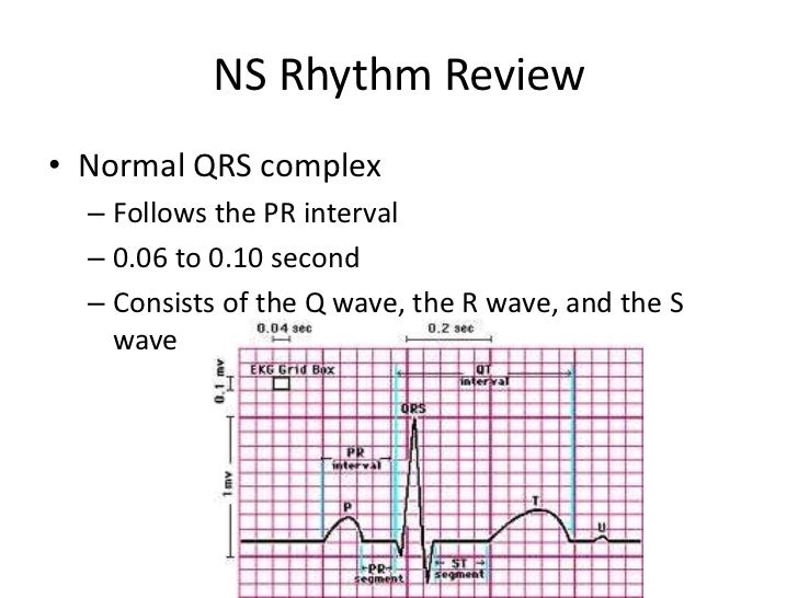 Normal sinus rhythm