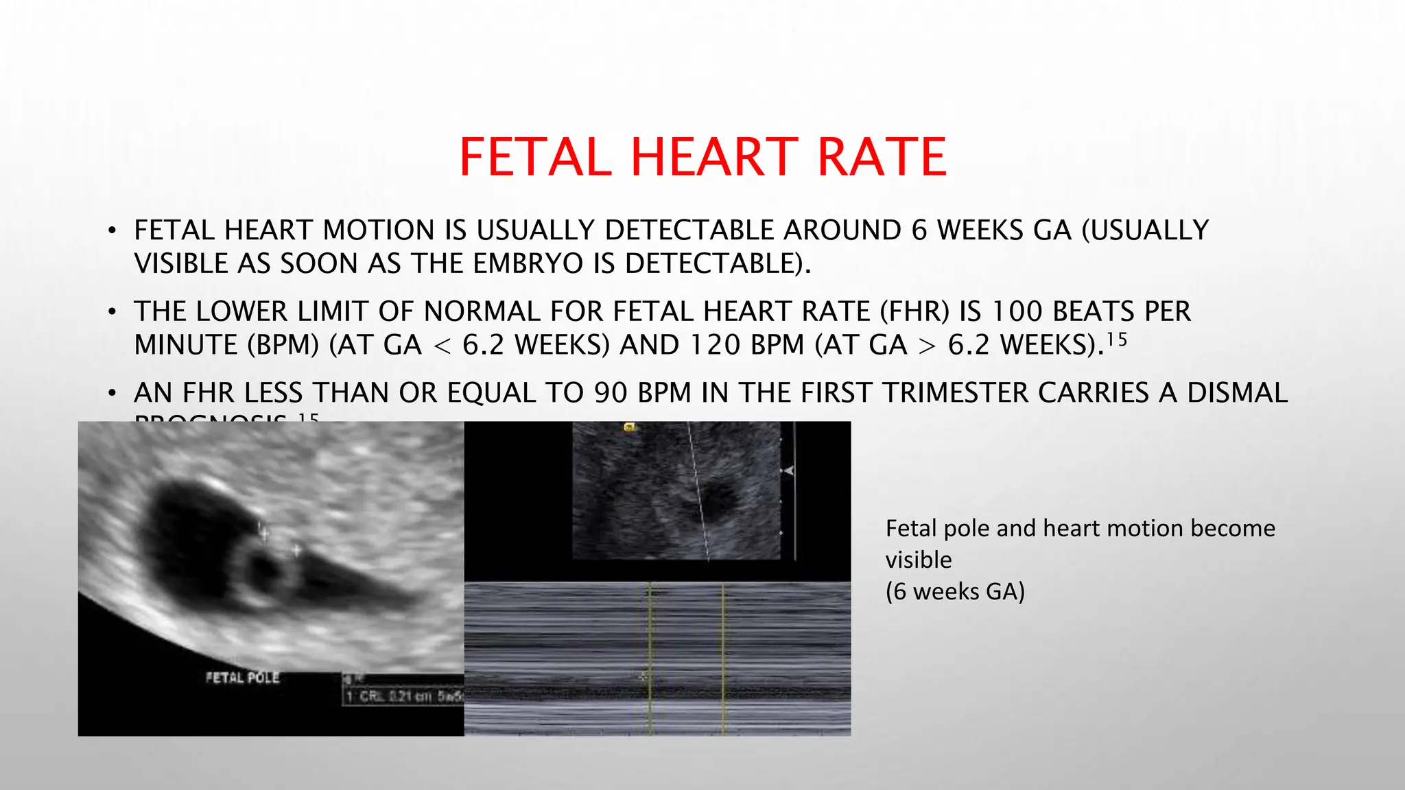 NORMAL SONOLOGICAL FINDING IN FRIST TRIMESTER.pptx