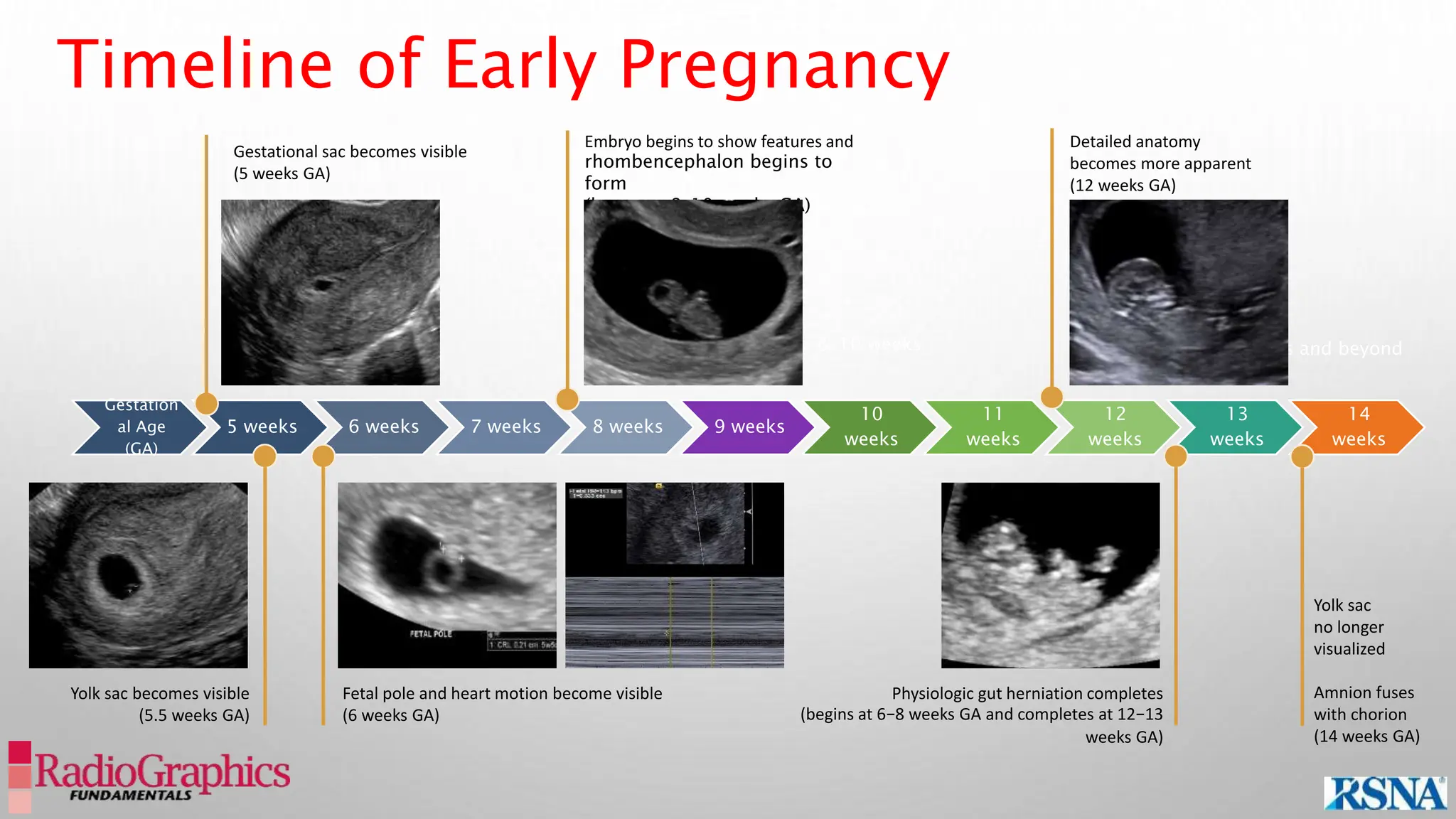 NORMAL SONOLOGICAL FINDING IN FRIST TRIMESTER.pptx
