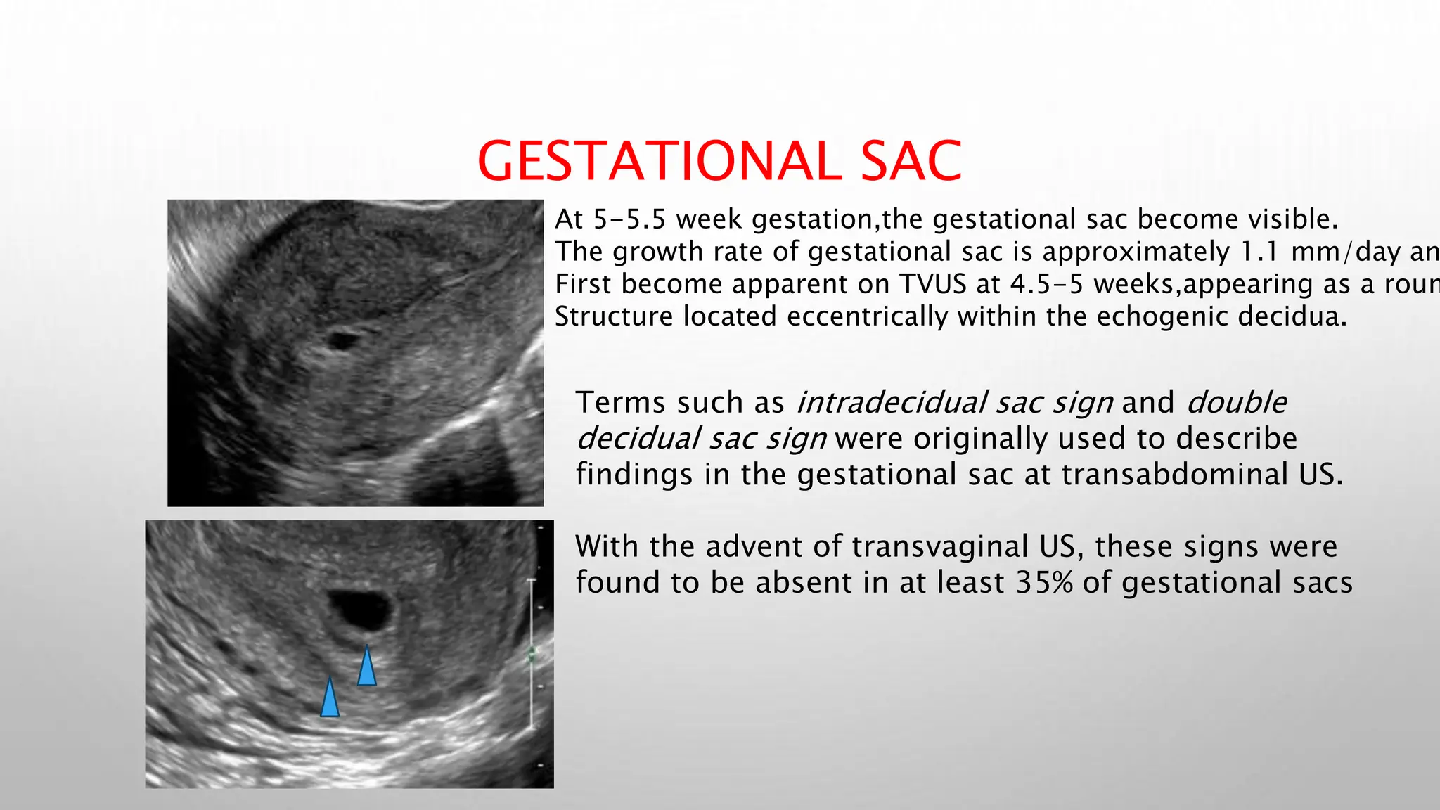 NORMAL SONOLOGICAL FINDING IN FRIST TRIMESTER.pptx