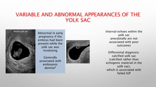 NORMAL SONOLOGICAL FINDING IN FRIST TRIMESTER.pptx