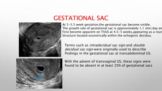 NORMAL SONOLOGICAL FINDING IN FRIST TRIMESTER.pptx