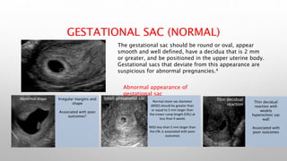 NORMAL SONOLOGICAL FINDING IN FRIST TRIMESTER.pptx
