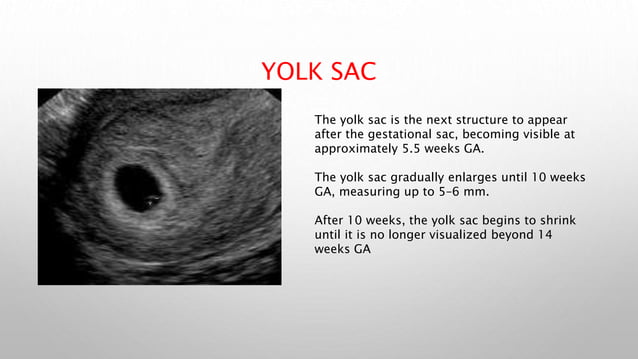 NORMAL SONOLOGICAL FINDING IN FRIST TRIMESTER.pptx