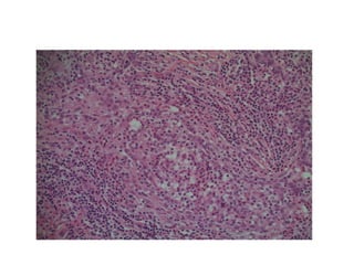 NORMAL STRUCTURE OF BREAST AND BENIGN LESIONS OF (2).pptx