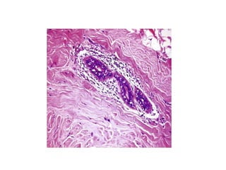 NORMAL STRUCTURE OF BREAST AND BENIGN LESIONS OF (2).pptx