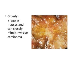 NORMAL STRUCTURE OF BREAST AND BENIGN LESIONS OF (2).pptx