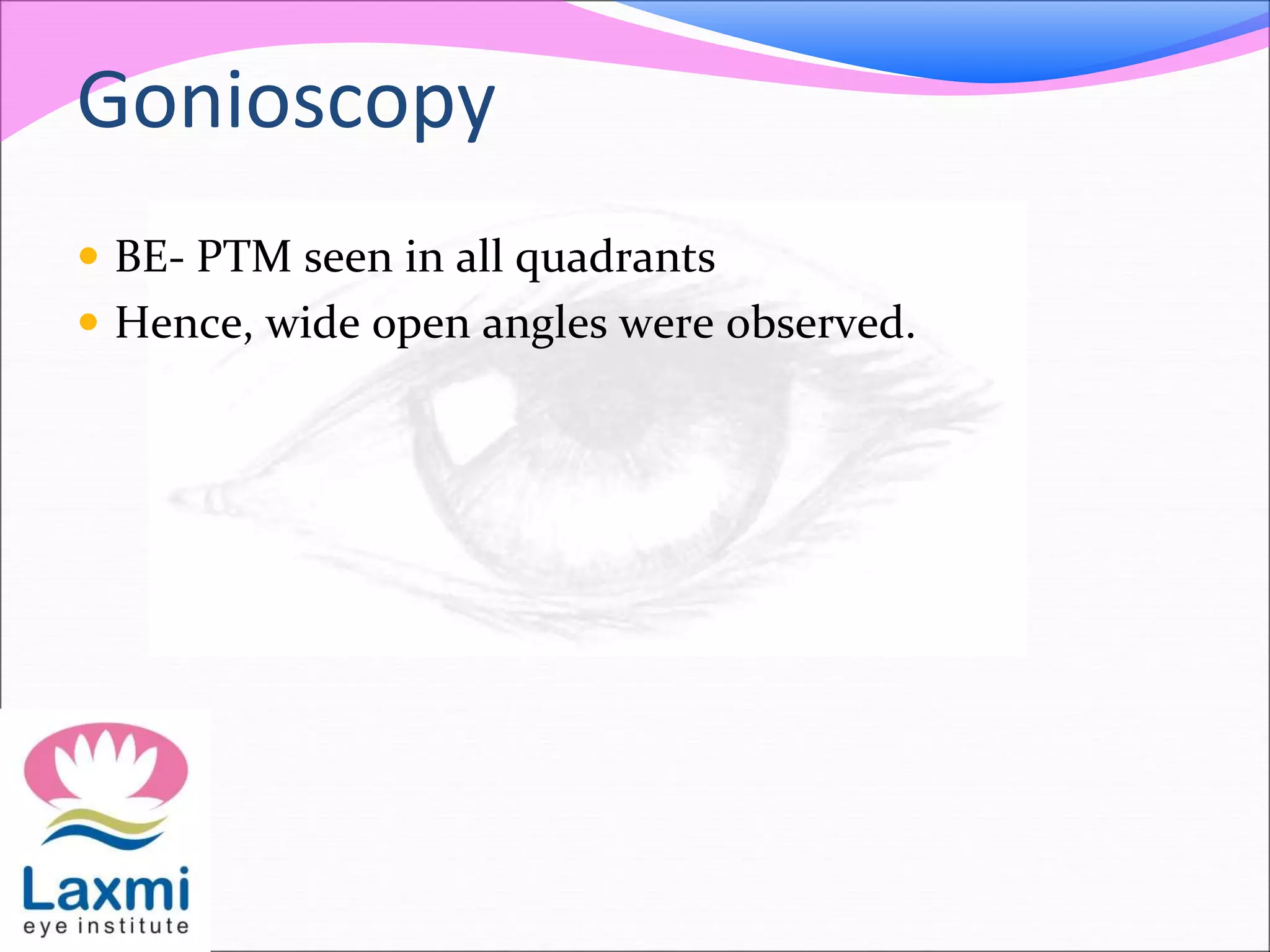 Normal tension glaucoma | PPTX