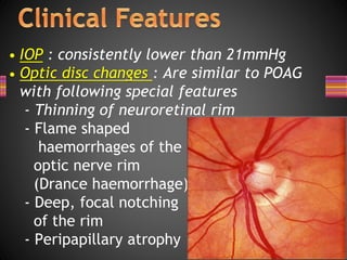 Normal tension glaucoma ntg | PPT
