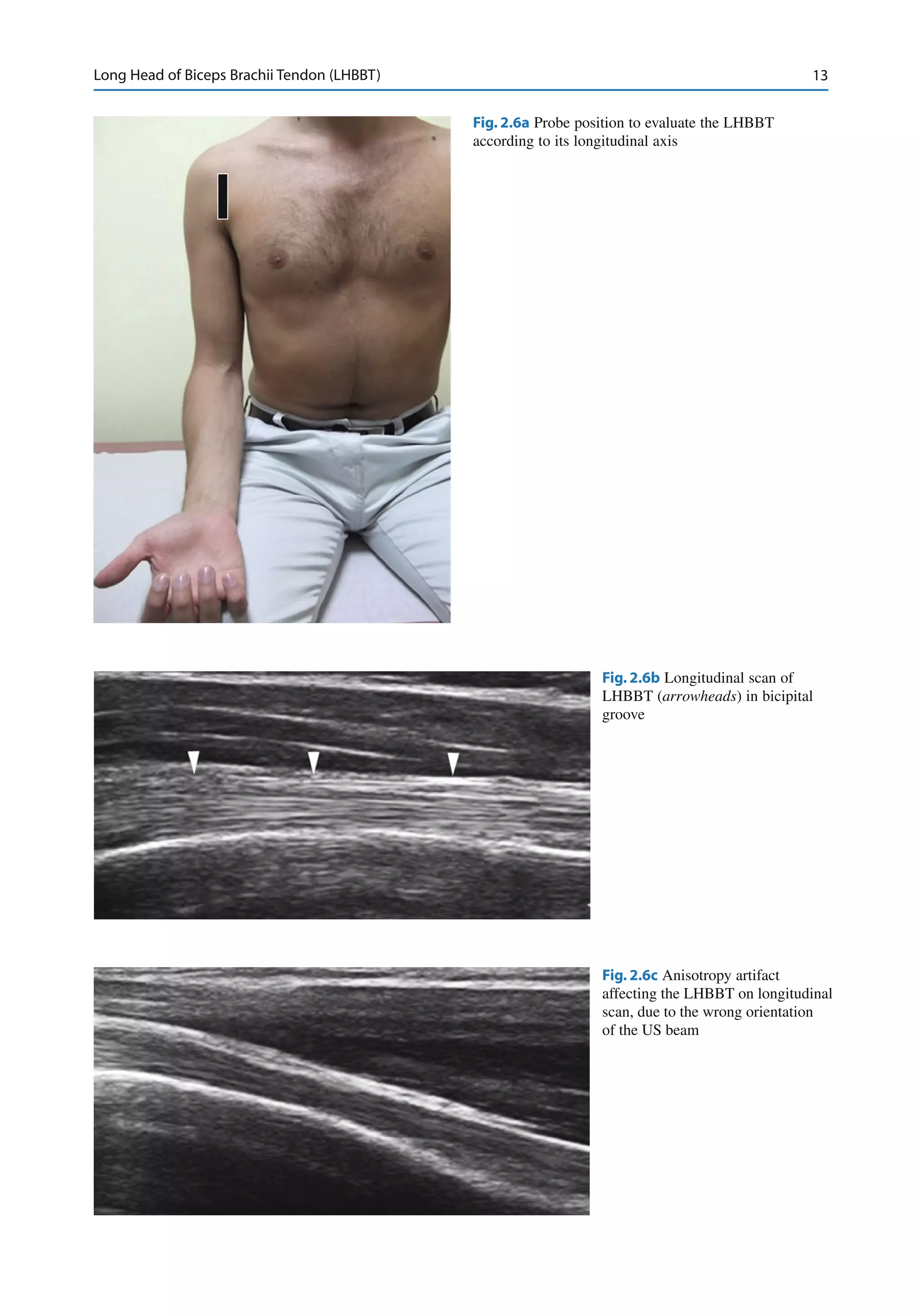 Normal ultrasound anatomy of the musculoskeletal system 2012 | PDF