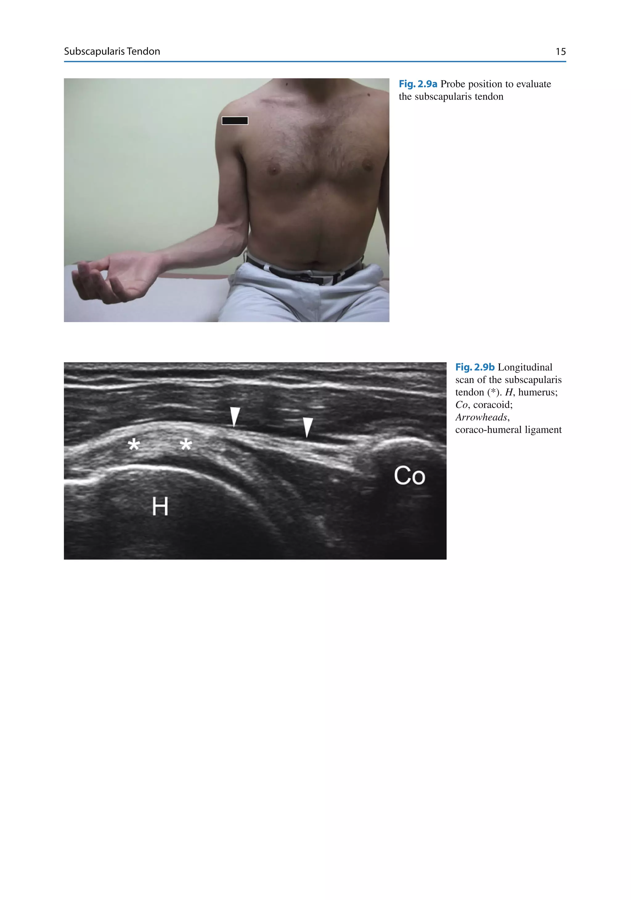 Normal ultrasound anatomy of the musculoskeletal system 2012 | PDF