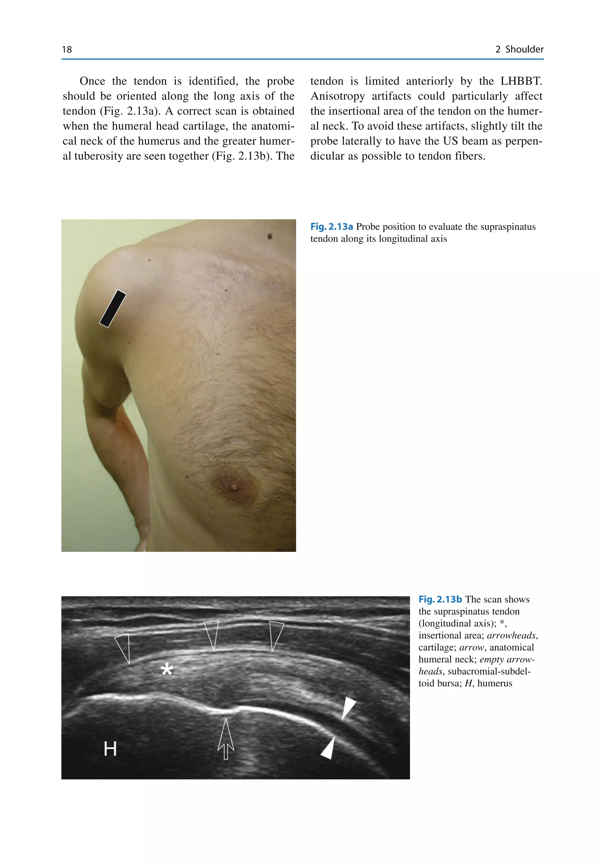 Normal ultrasound anatomy of the musculoskeletal system 2012 | PDF