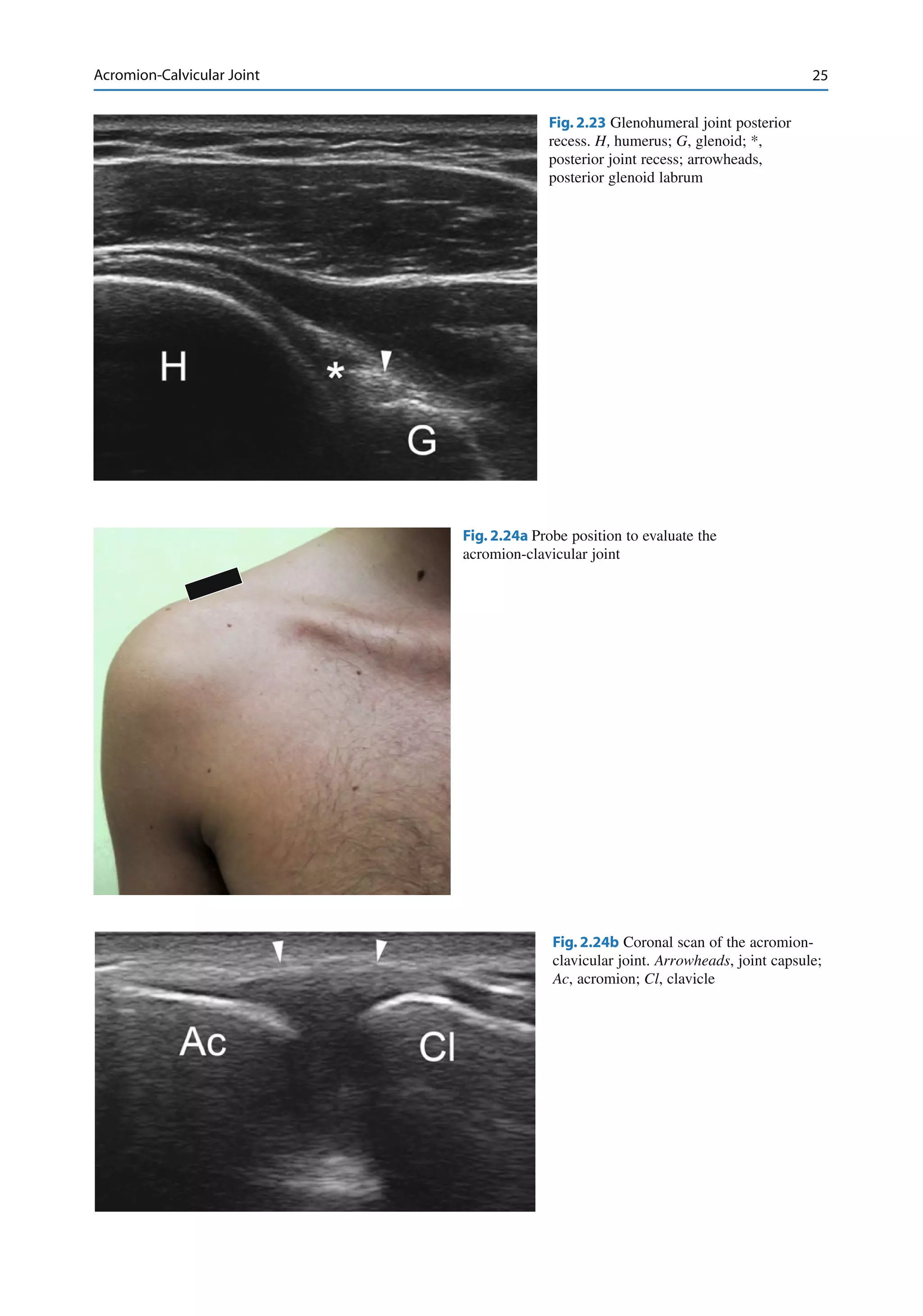 Normal ultrasound anatomy of the musculoskeletal system 2012 | PDF
