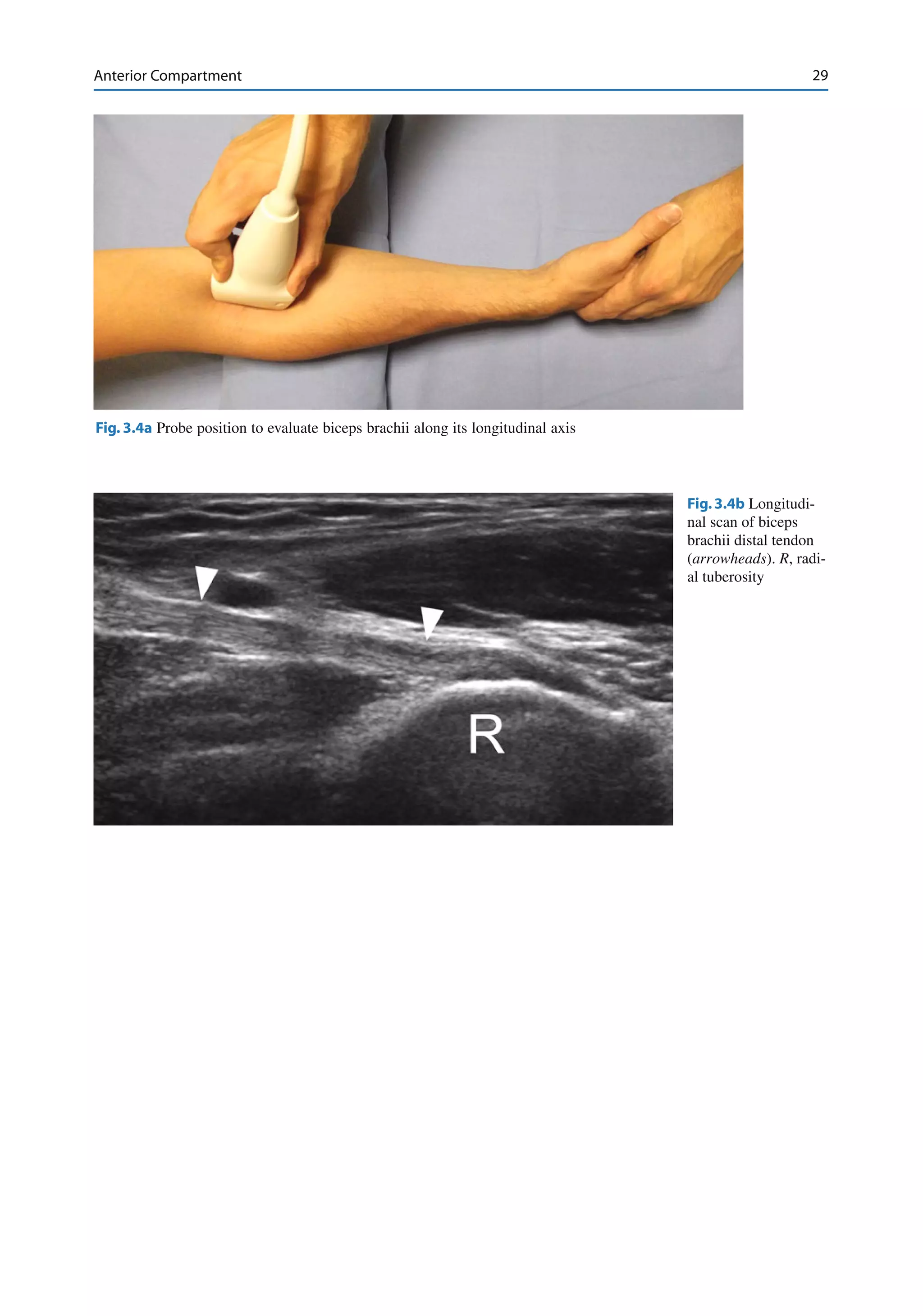 Normal ultrasound anatomy of the musculoskeletal system 2012 | PDF