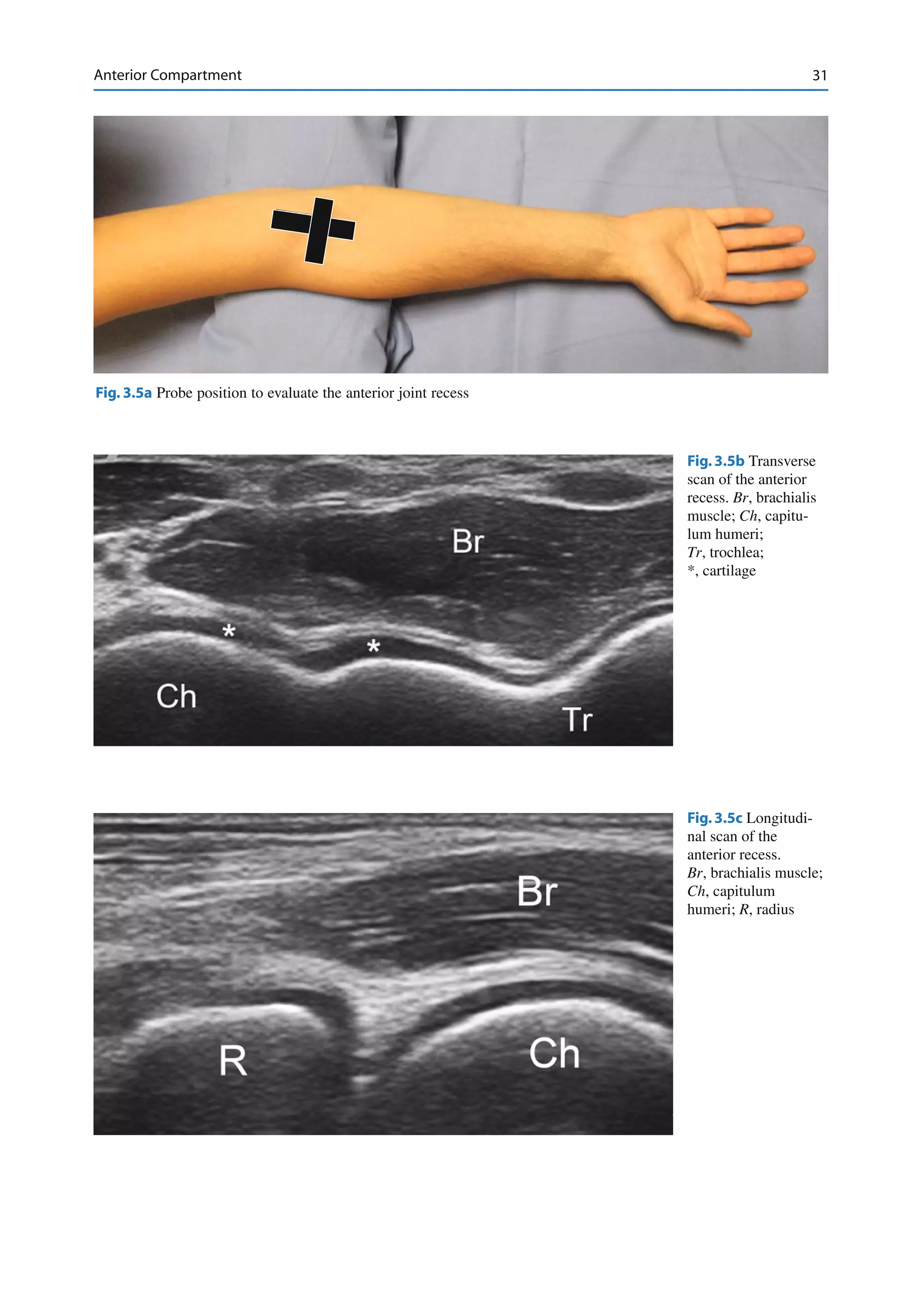 Normal ultrasound anatomy of the musculoskeletal system 2012 | PDF