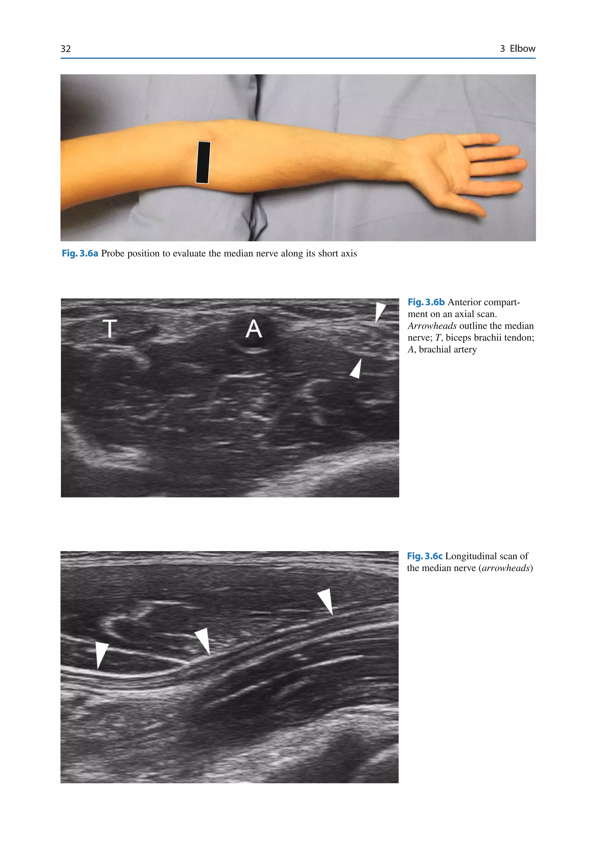 Normal ultrasound anatomy of the musculoskeletal system 2012 | PDF