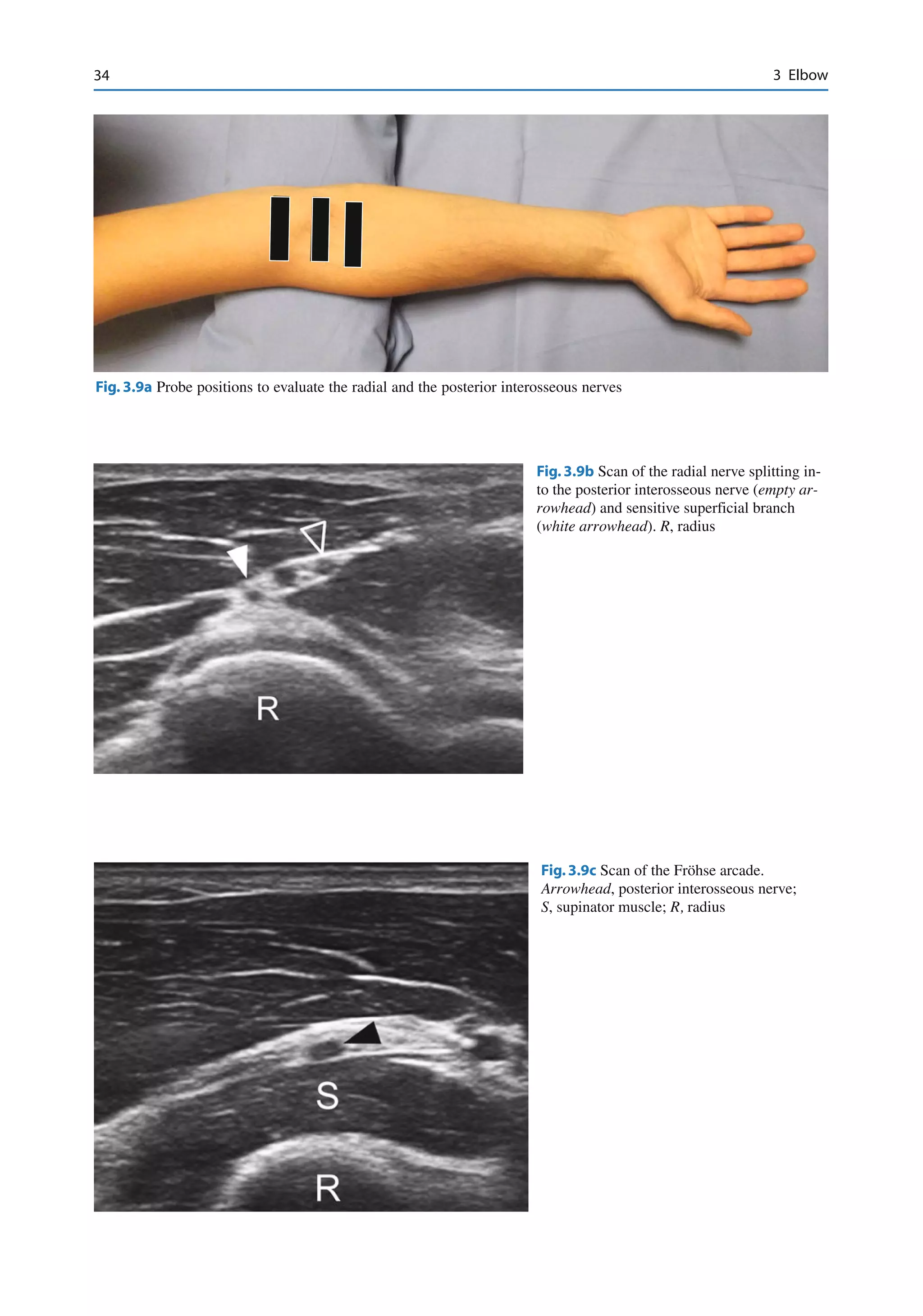 Normal ultrasound anatomy of the musculoskeletal system 2012 | PDF