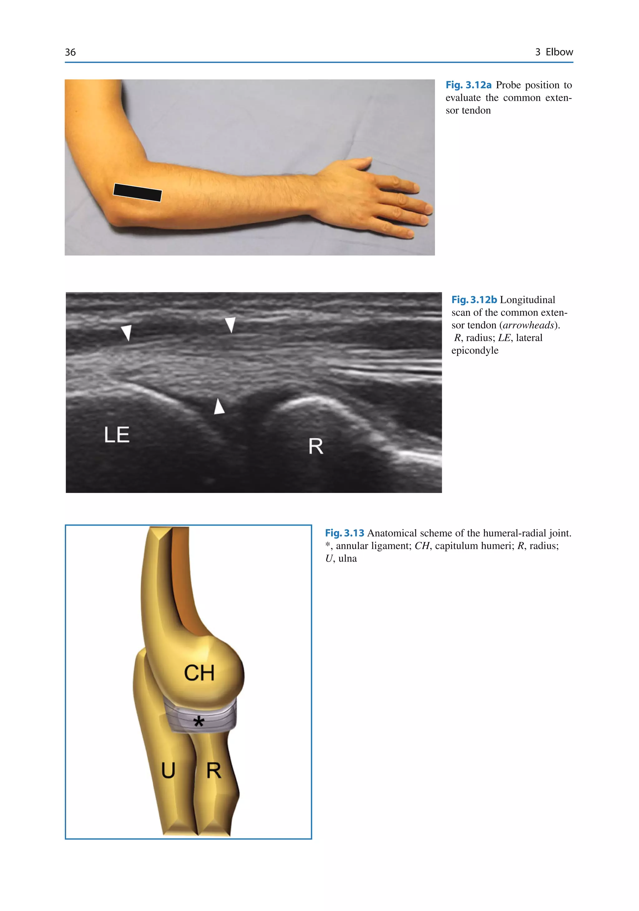 Normal ultrasound anatomy of the musculoskeletal system 2012 | PDF