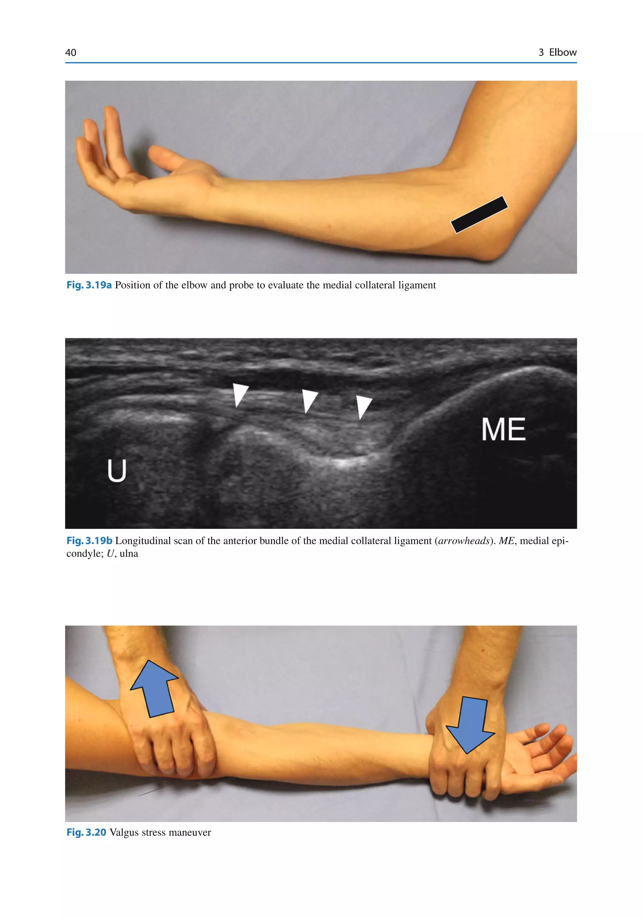 Normal ultrasound anatomy of the musculoskeletal system 2012 | PDF