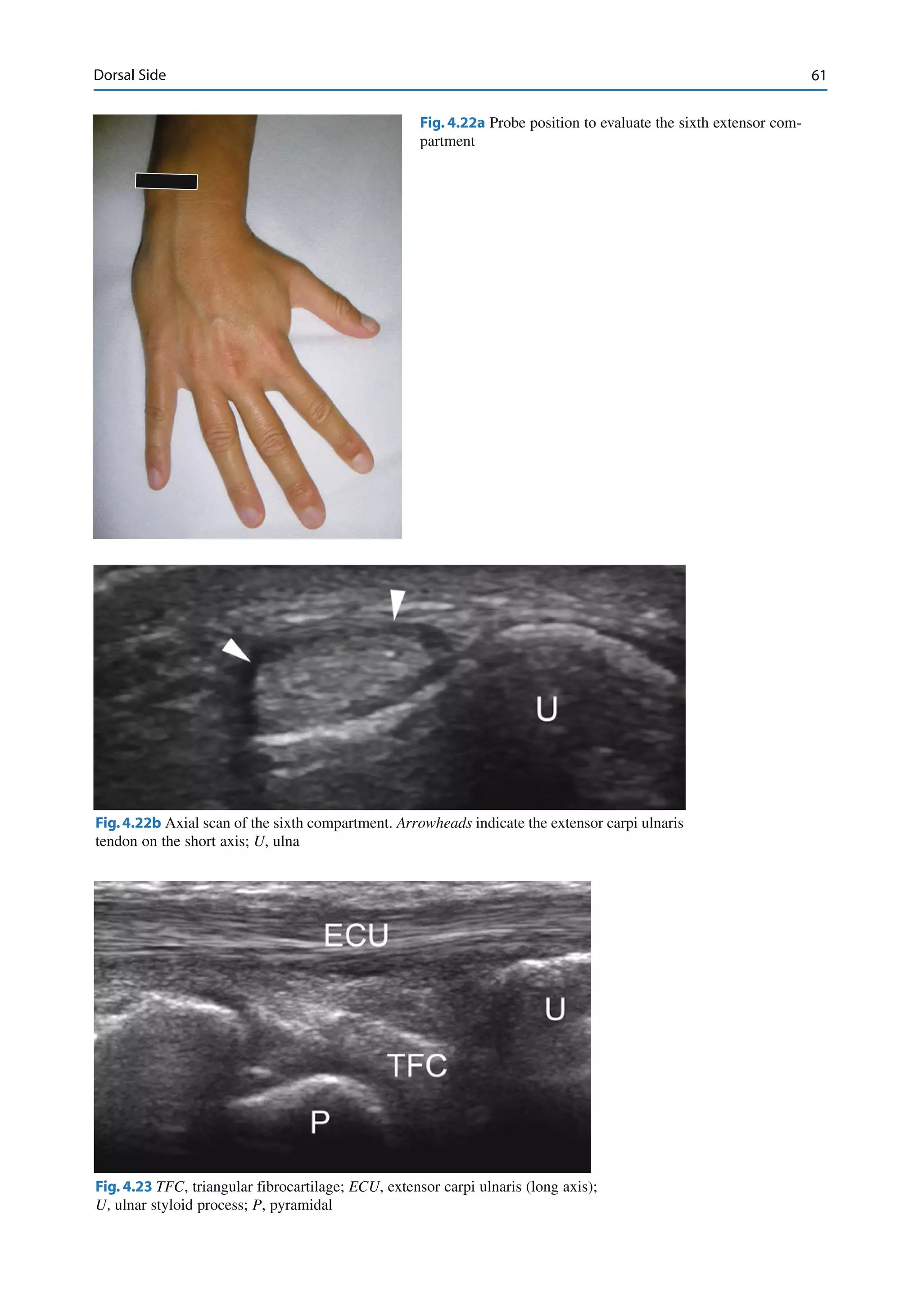 Normal ultrasound anatomy of the musculoskeletal system 2012 | PDF
