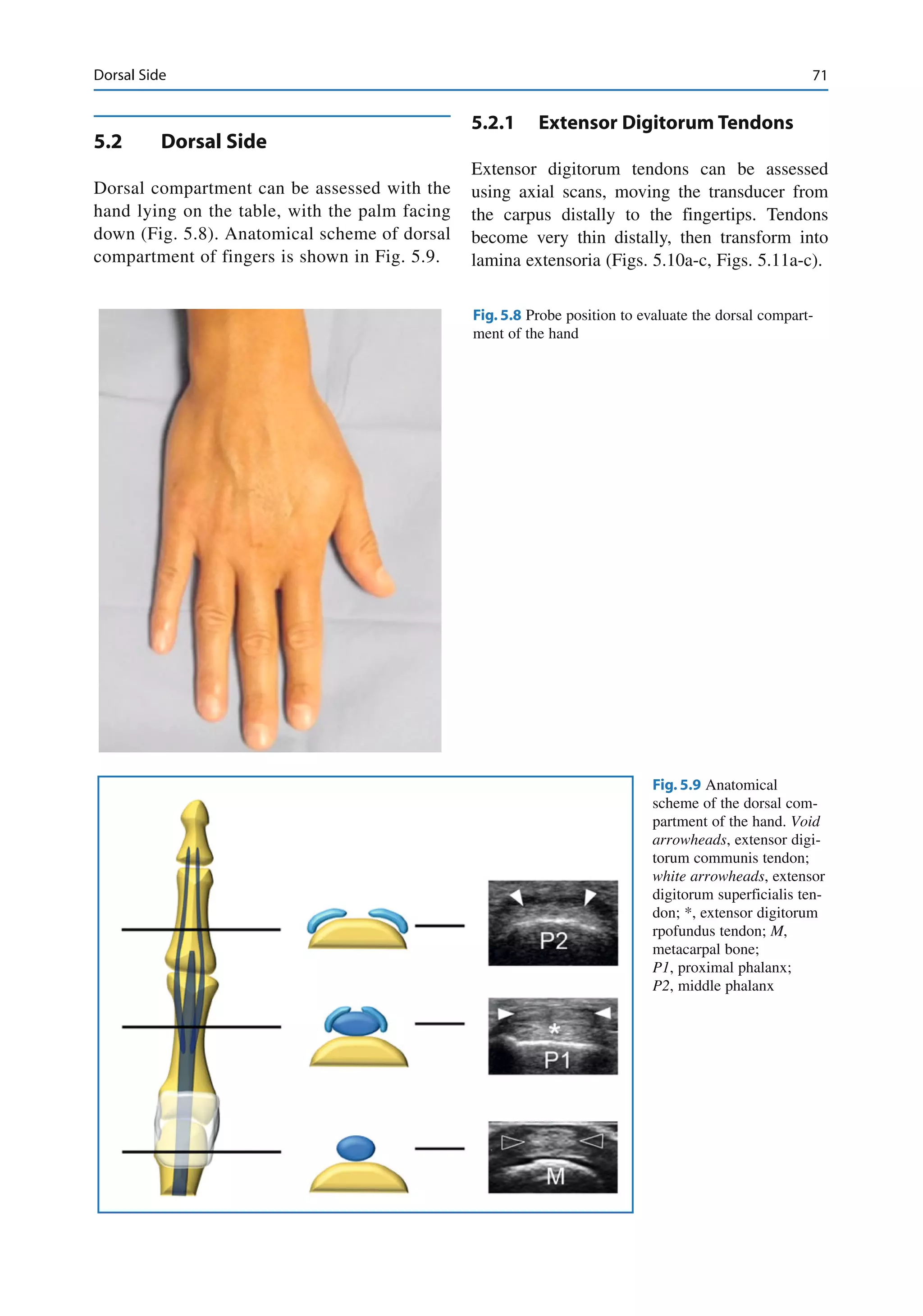 Normal ultrasound anatomy of the musculoskeletal system 2012 | PDF