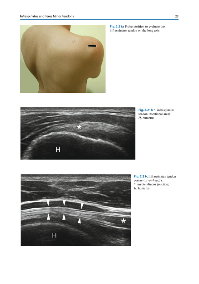 Normal ultrasound anatomy of the musculoskeletal system 2012 | PDF