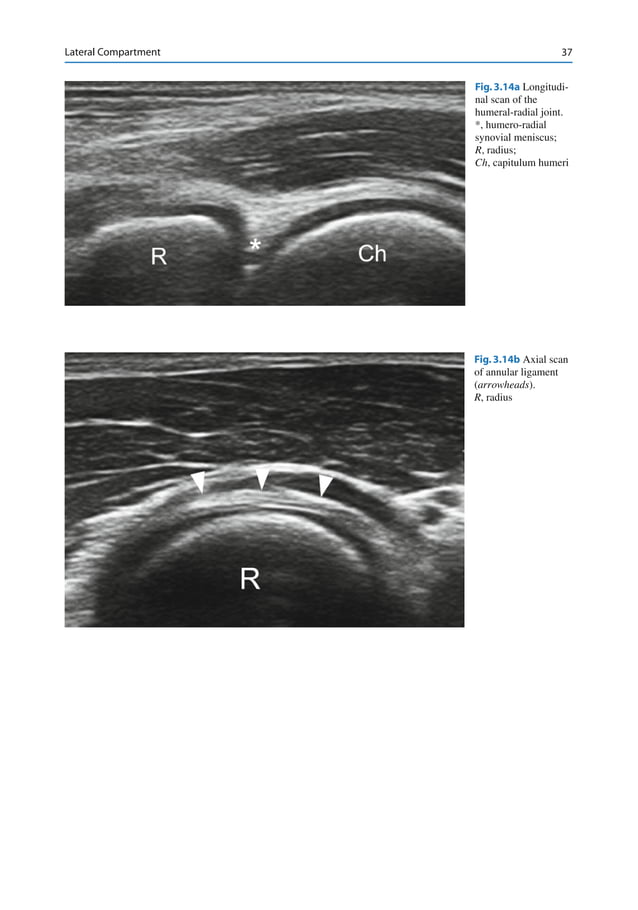 Normal ultrasound anatomy of the musculoskeletal system 2012 | PDF