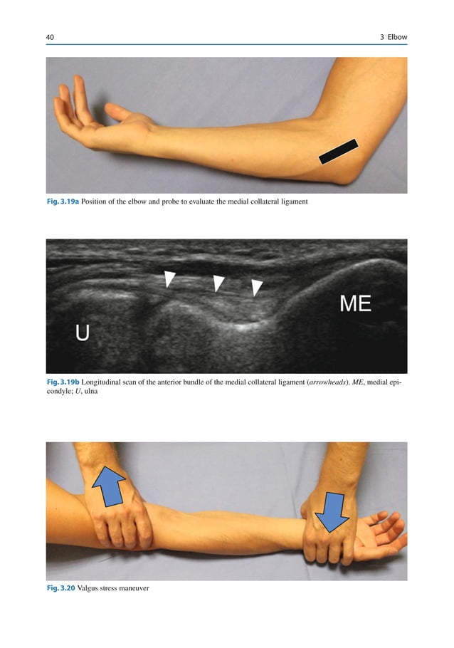 Normal ultrasound anatomy of the musculoskeletal system 2012 | PDF