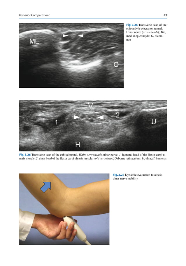 Normal ultrasound anatomy of the musculoskeletal system 2012 | PDF