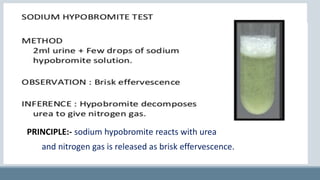 Test for Normal urine (Practical ) | PPTX