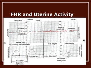 Normal uterine action | PPTX